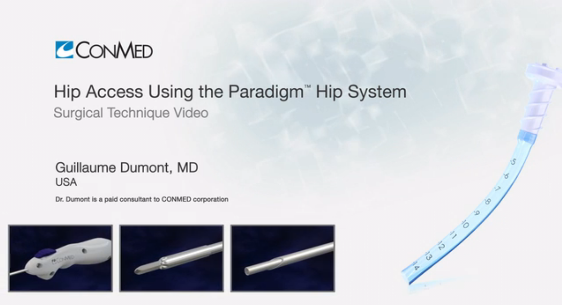 Hip Access Using The Paradigm™ Hip System-orthopaedic Solutions – Hip ...