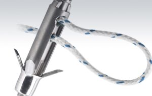 Ultrafix® Knotless Minimite® Suture Anchor-orthopaedic Solutions – Hand ...