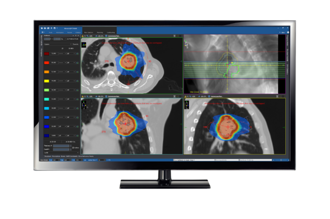 TREATMENT PLANNING – Monaco - Medhold Medical