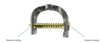 RibLoc U Plus Chest Wall Plating System - Medhold Medical