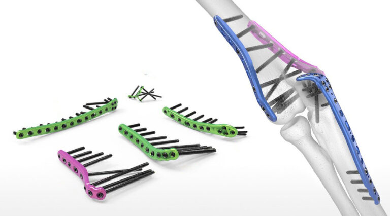 Elbow Plating System- Elbow Plating Fixation Products - Medhold Medical