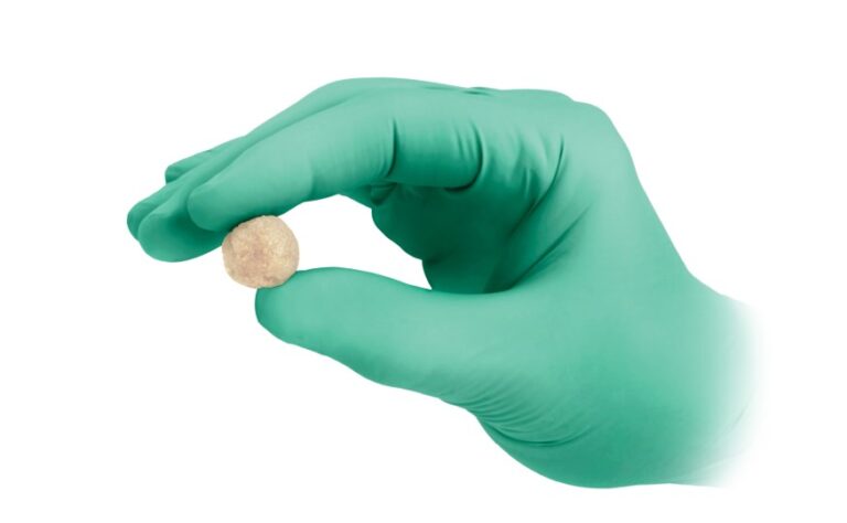 SteriFuse® DBM Putty | Bone Grafting Solutions | Medhold Medical SA ...